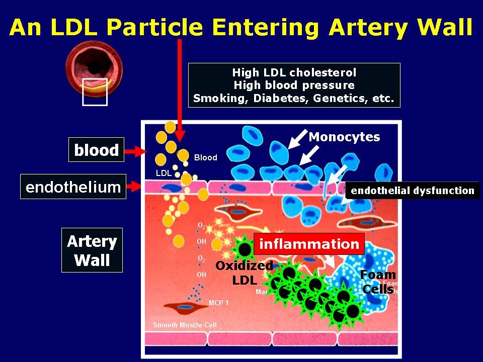LDL Entering Artery Wall | Advanced Cholesterol Clinic | RdeGoma